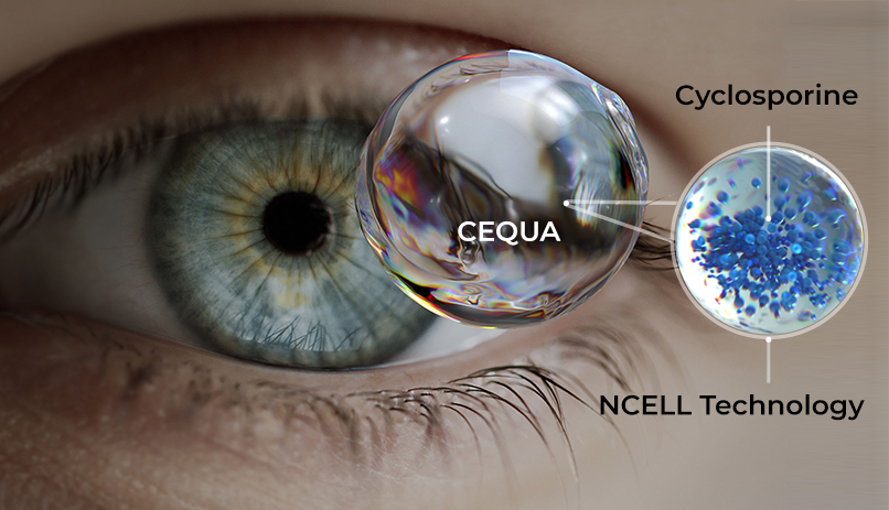 CEQUA® for Chronic Dry Eye | How CEQUA Works